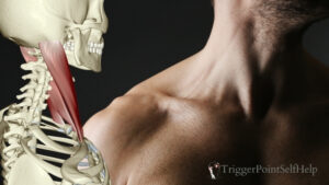 Sternocleidomastoid Trigger Points and Referred Pain Patterns | Trigger ...